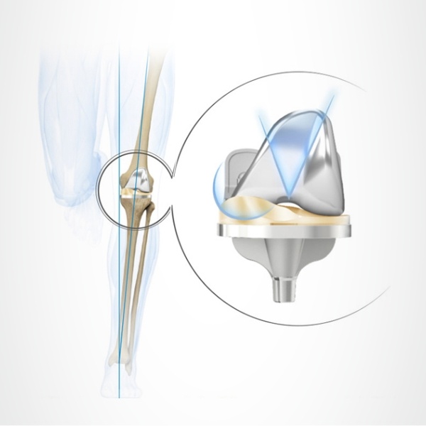 Kinematic Alignment Webinar